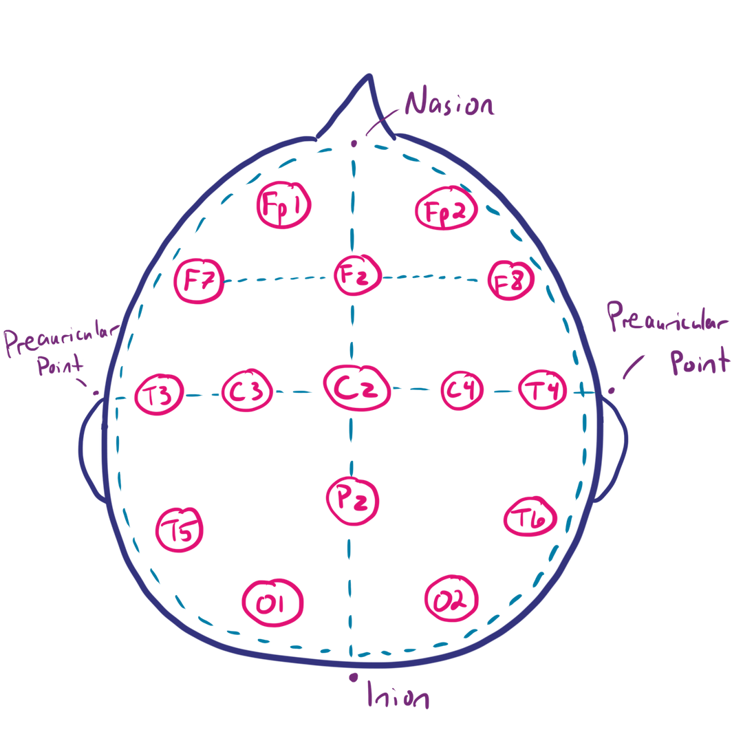 EEG Montages and Technical Components