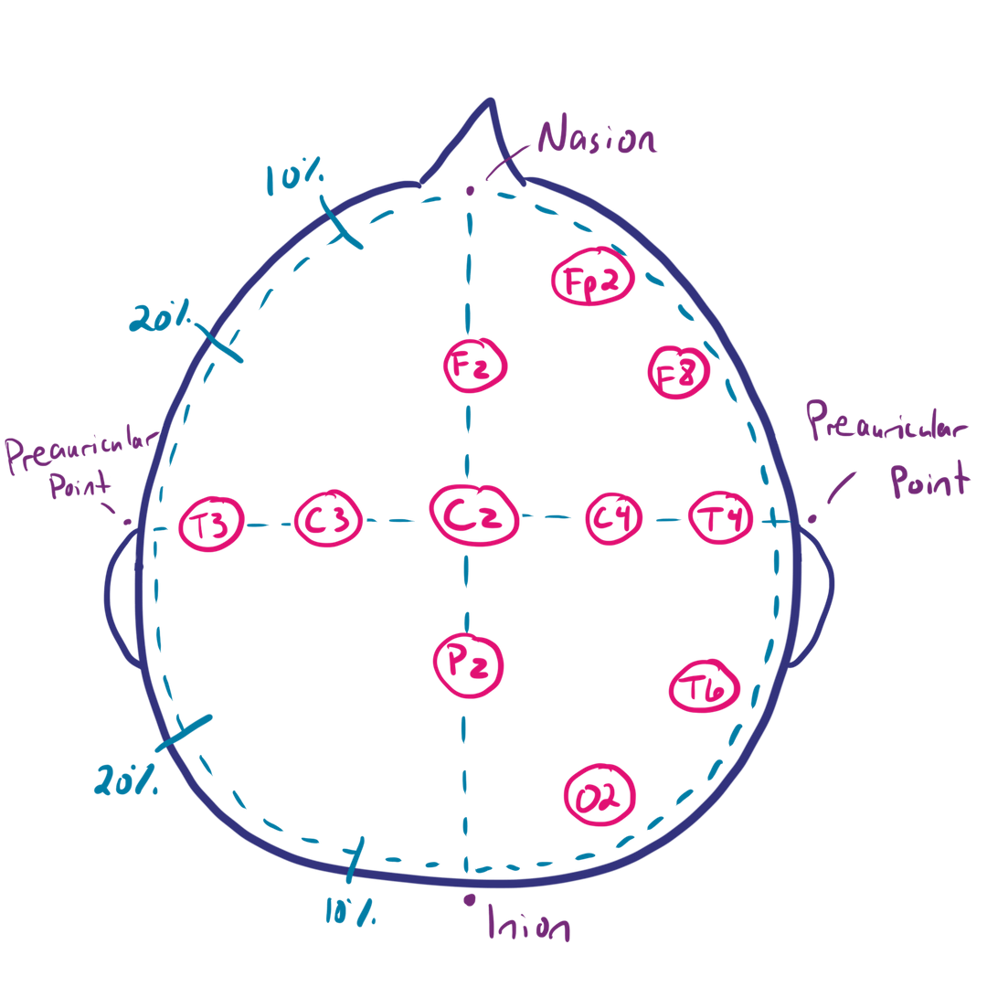 EEG Montages and Technical Components