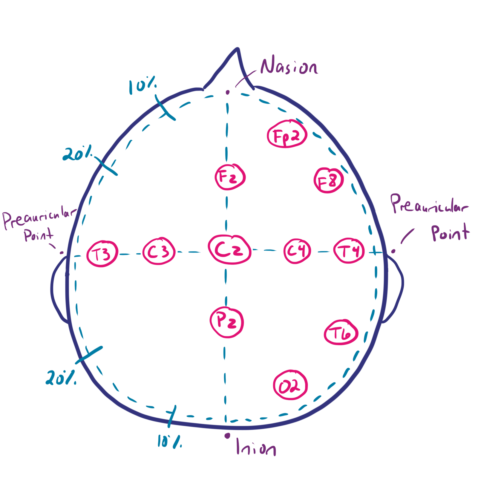 EEG Montages and Technical Components