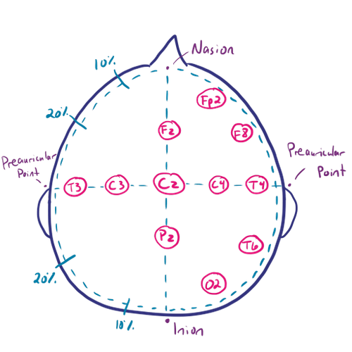 EEG Montages and Technical Components