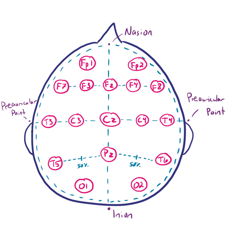 EEG Montages and Technical Components