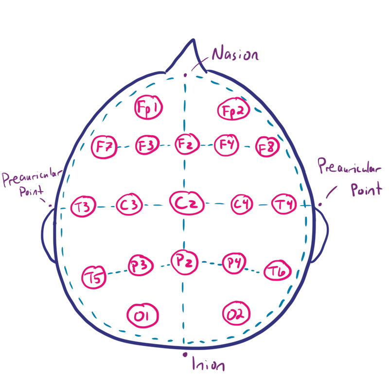 EEG Montages and Technical Components