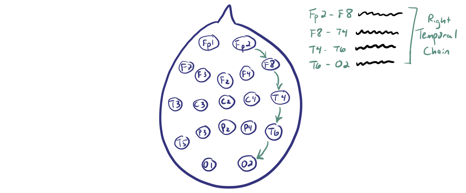 EEG Montages and Technical Components