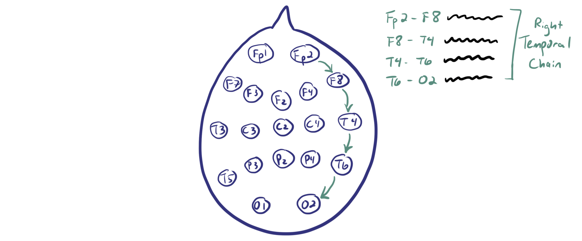 EEG Montages and Technical Components