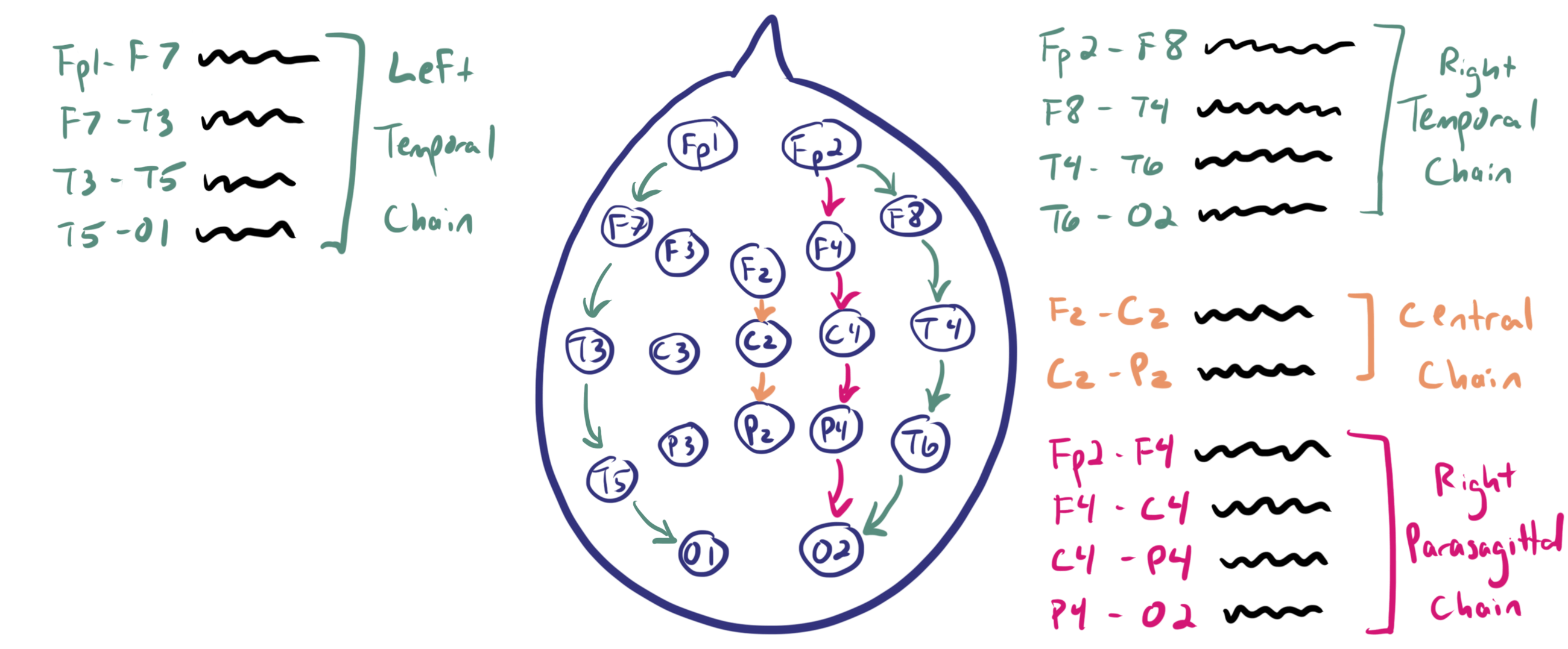 EEG Montages and Technical Components