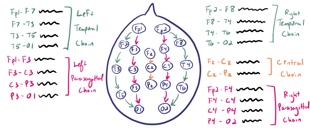 EEG Montages and Technical Components