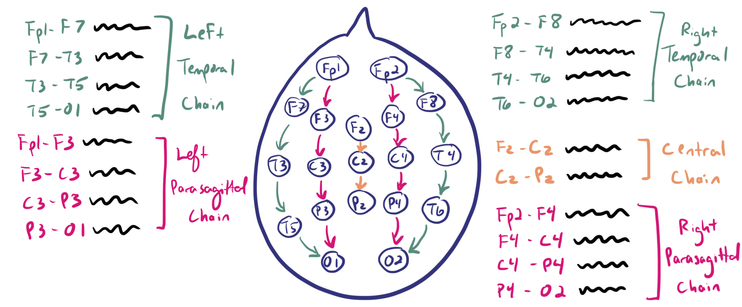 EEG Montages and Technical Components