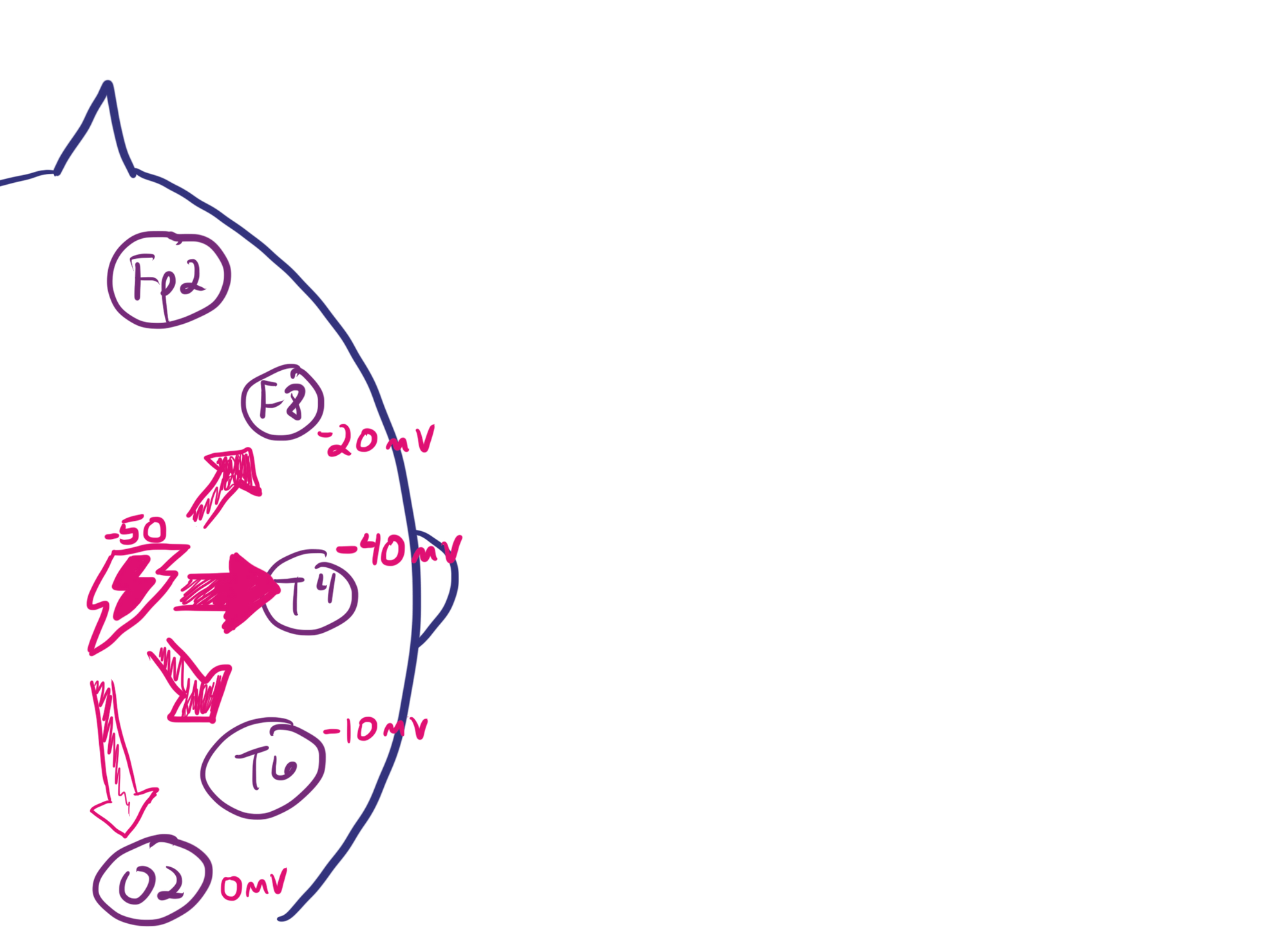EEG Montages and Technical Components