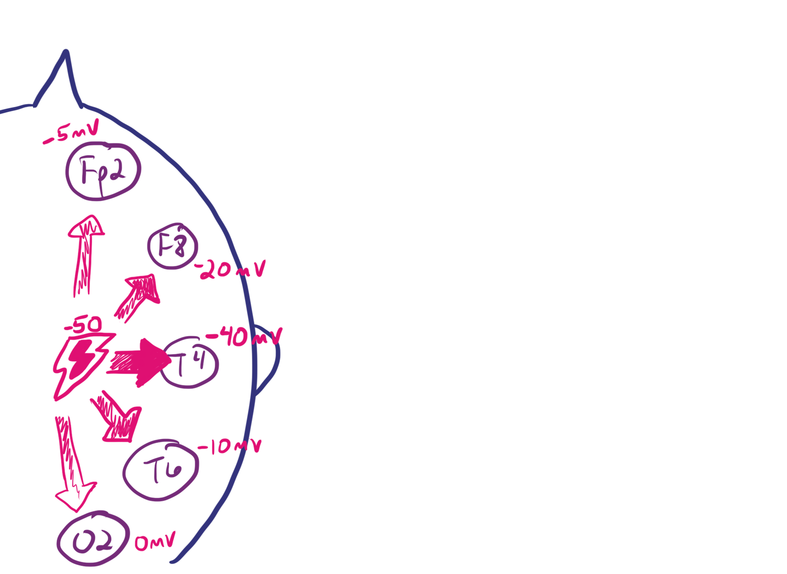 EEG Montages and Technical Components