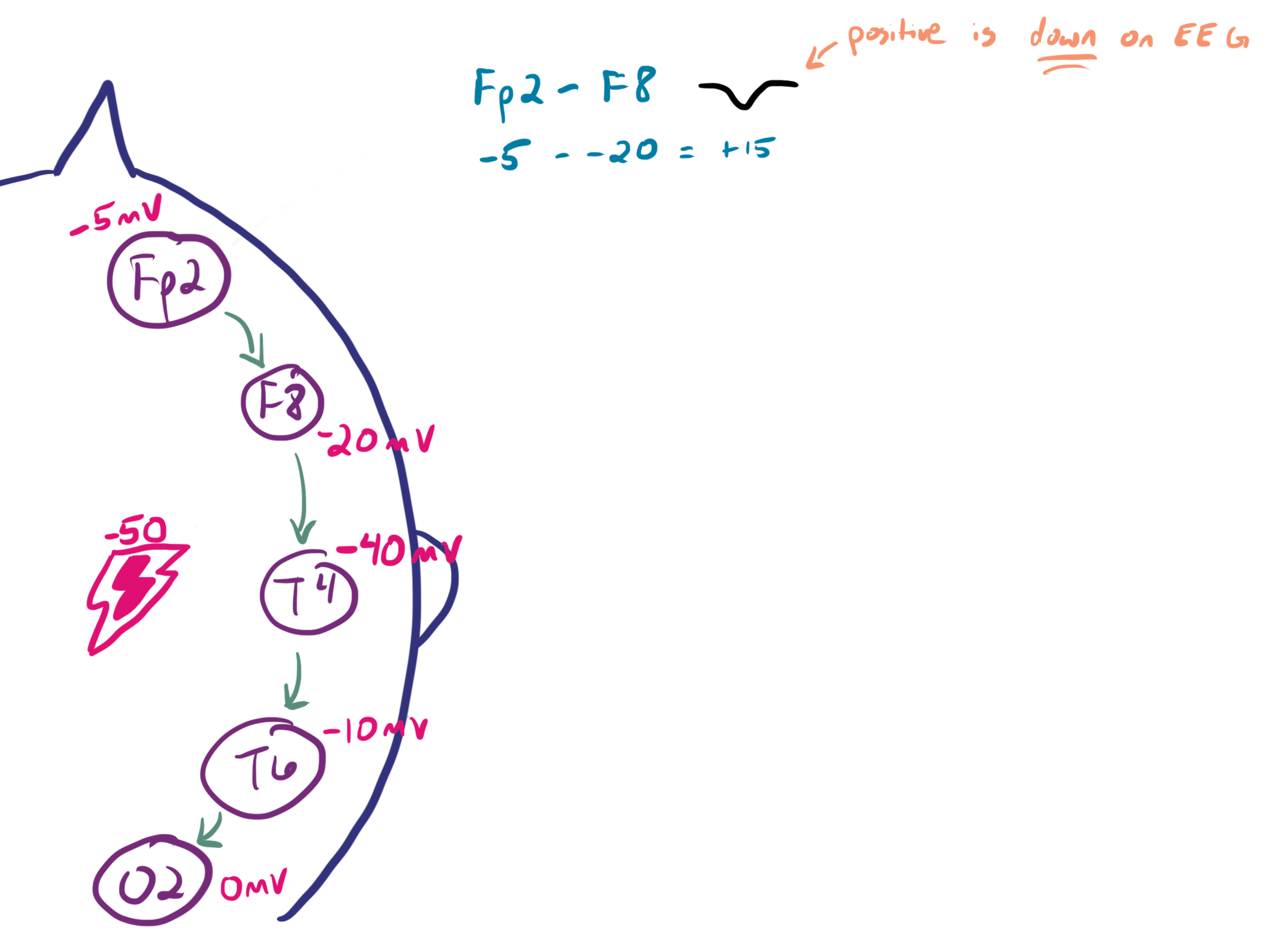 EEG Montages and Technical Components