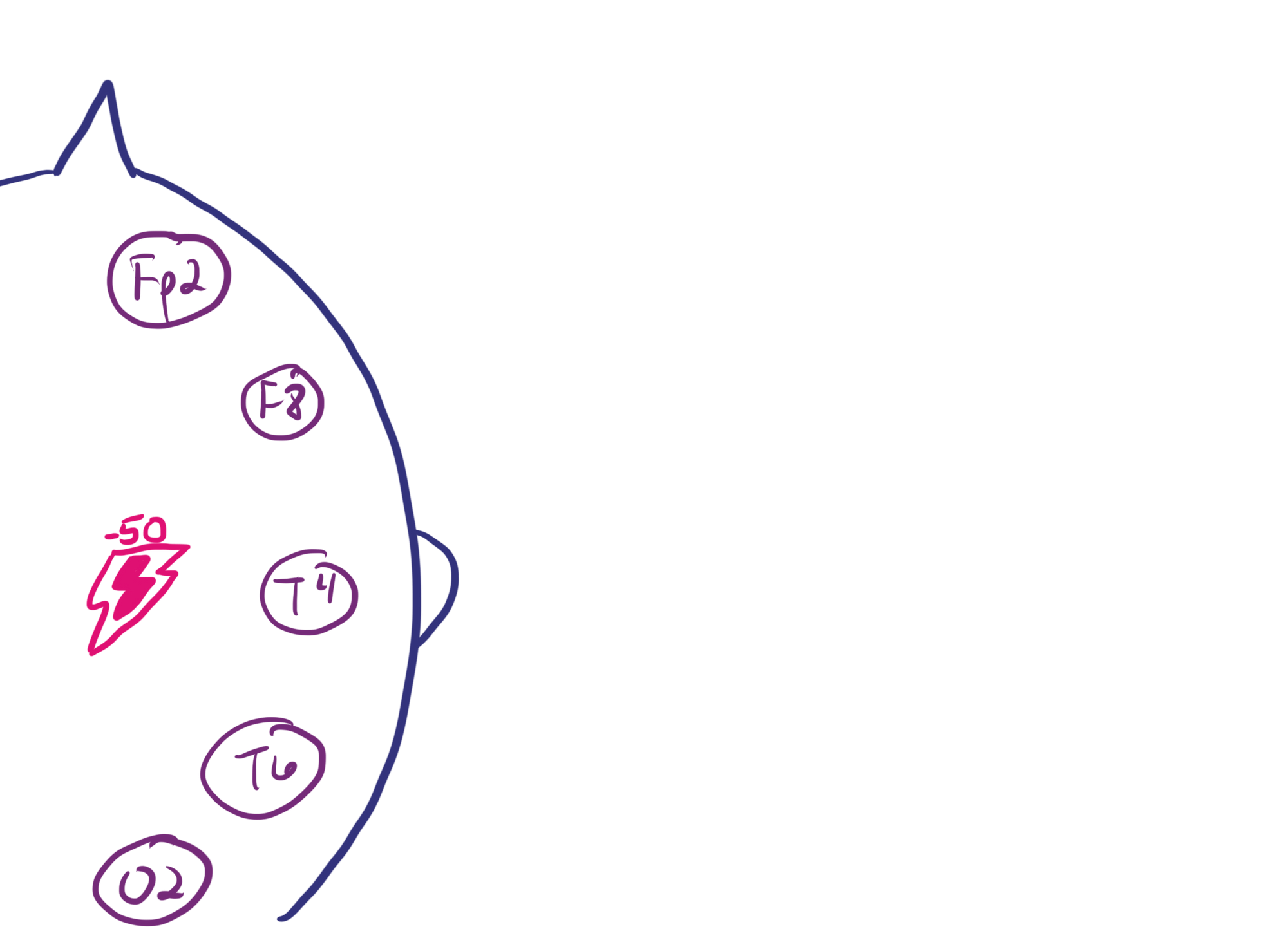 EEG Montages and Technical Components