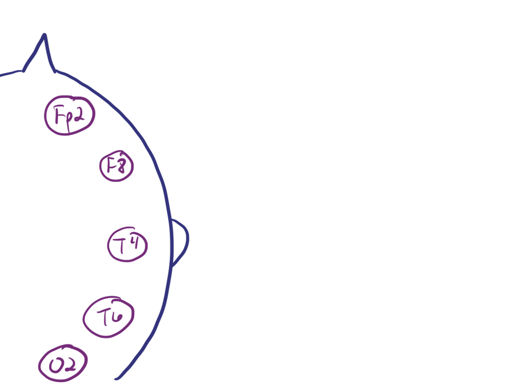 EEG Montages and Technical Components