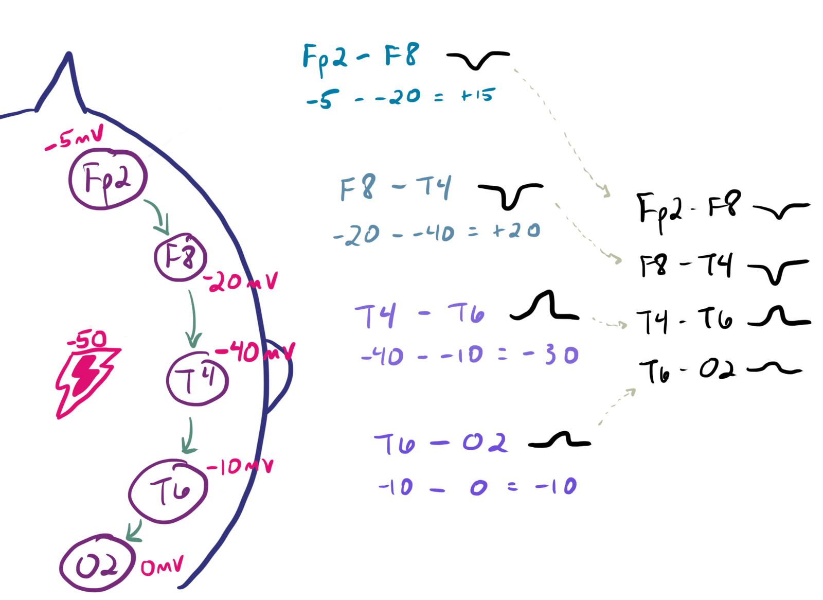 EEG Montages and Technical Components
