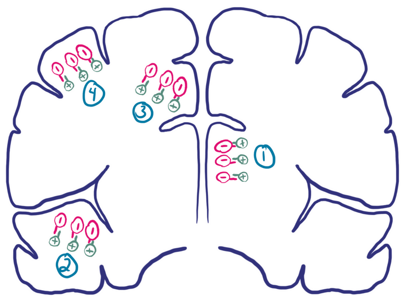 Basic EEG Electrophysiology
