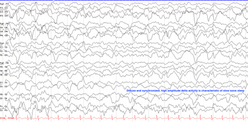 The Normal Asleep EEG