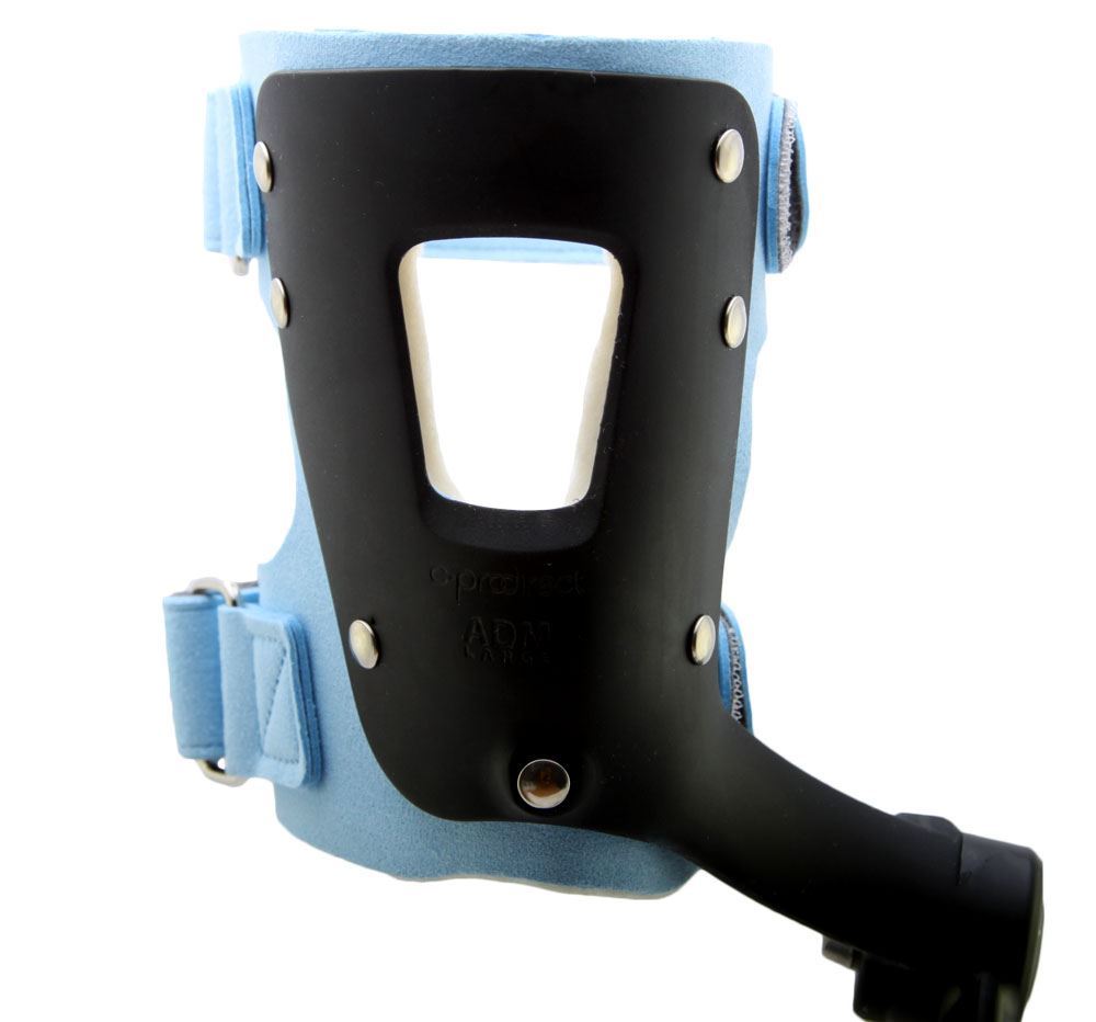 Single ADM mechanism | CPRO | Clubfoot/Ponseti