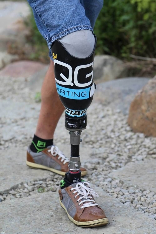 META Shock Foot | WillowWood | Waterproof Prosthetic Feet