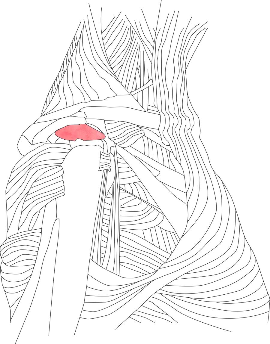 Subacromial Bursitis - Shoulder Clinic