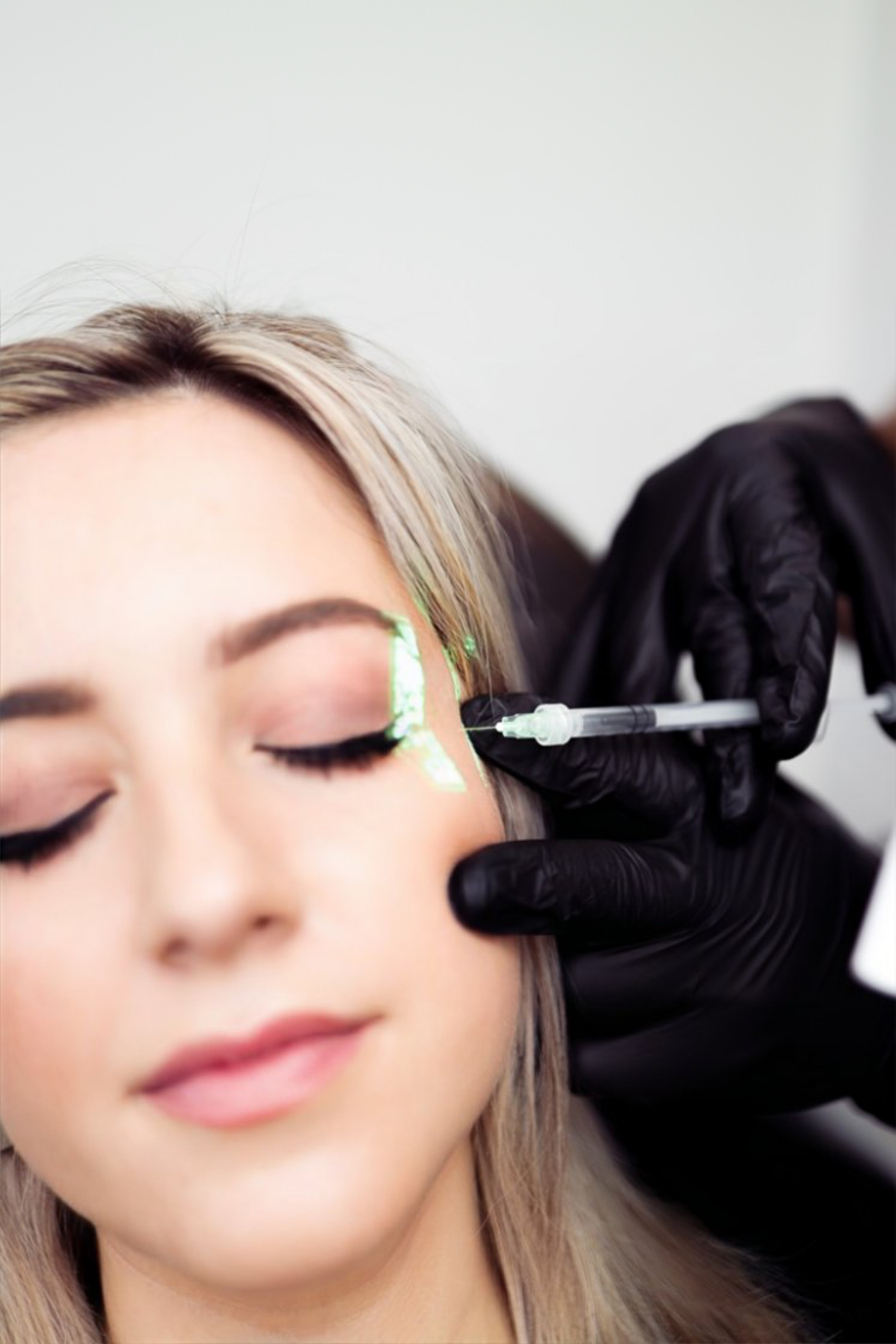 Botox Injections for Facial Wrinkles