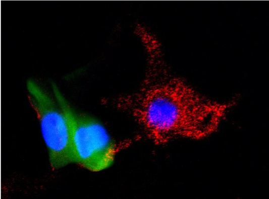 Melanocytes from iPSC and Culture Medium | Cell Models | Phenocell
