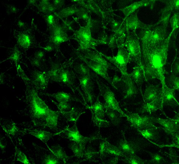 Melanocytes from iPSC and Culture Medium | Cell Models | Phenocell