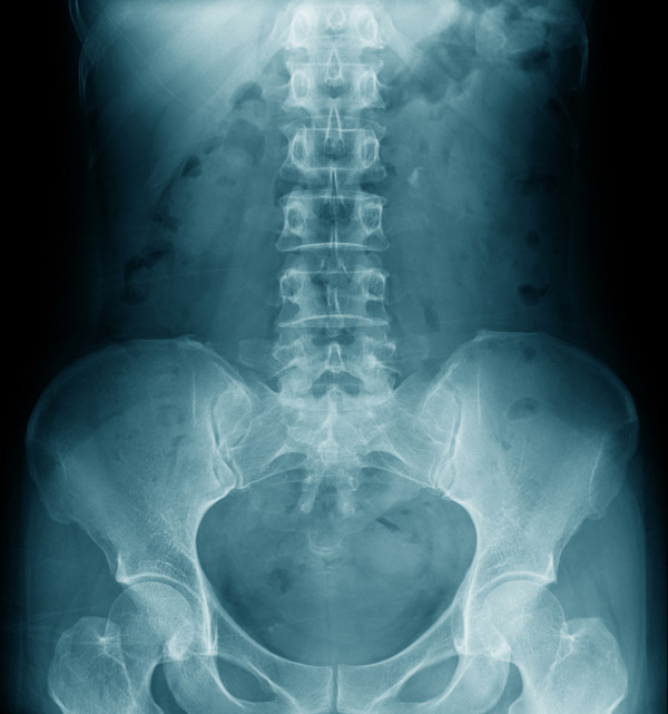 Rx Home - Radiologie a domicilio