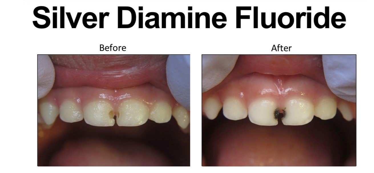 Sound Dental Care - Mobile Dental Services For Assisted Living & Senior ...