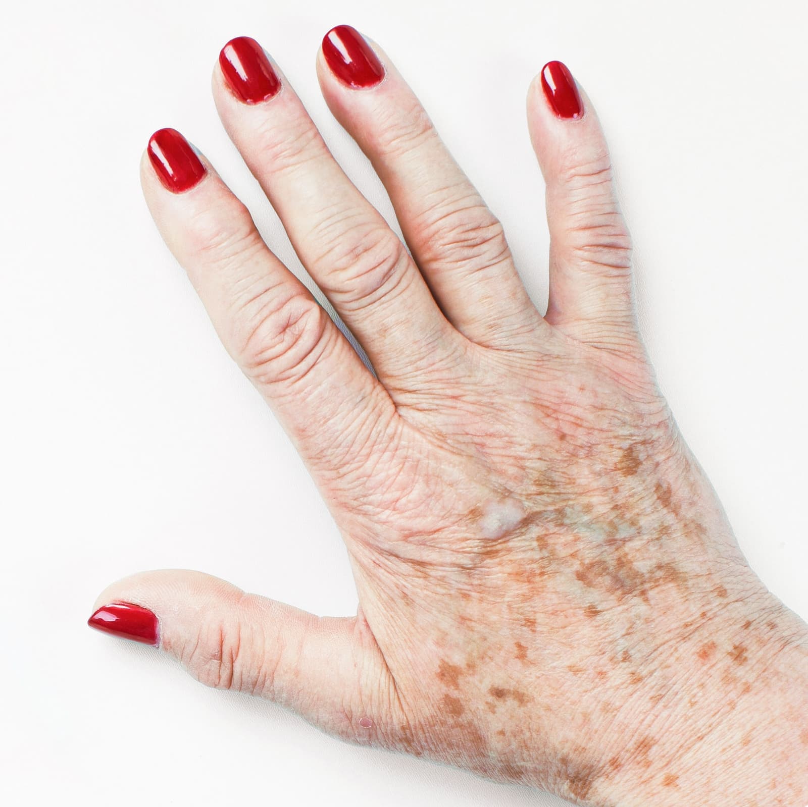 Spot Check: skin cancer + aesthetics. Melbourne CBD.