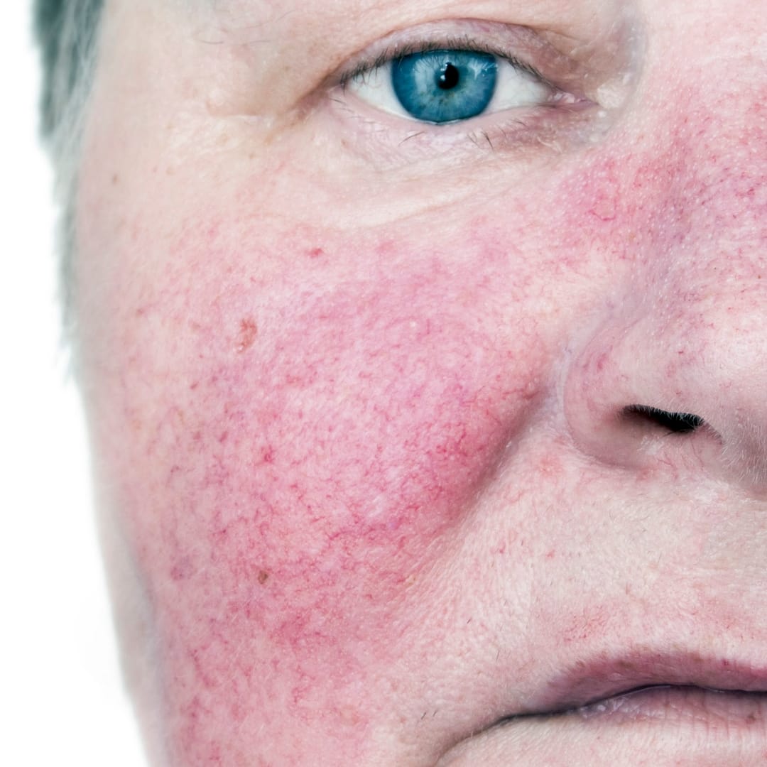 Spot Check Clinic: Skin cancer and skin health clinic, Melbourne CBD.