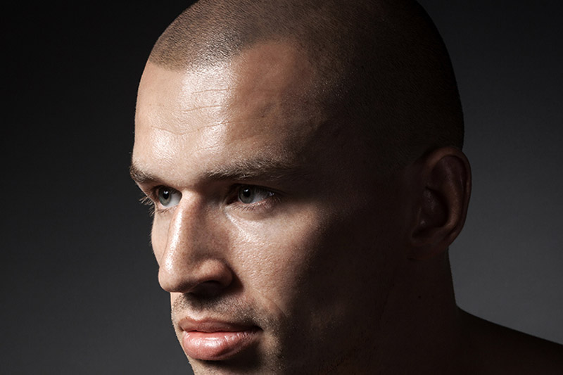 Tricopigmentation - Academy of Anna Maria Finelli