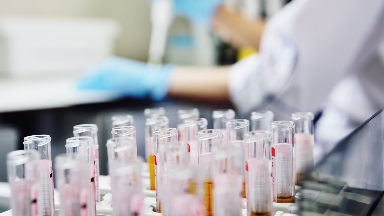 Drug Testing
