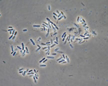 Take Good Care of Nitrifying Bacteria in the Aquarium - ONEdersave blog ...