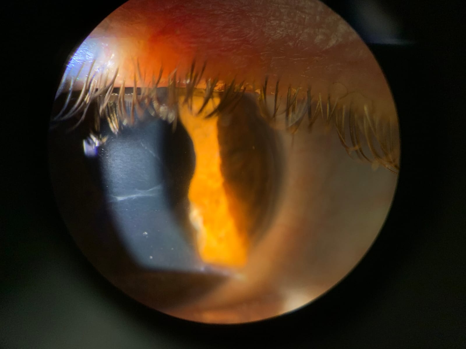 Blog - Rodolfo Moura | Contactologia Avançada