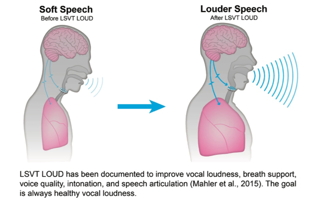 How can a Speech Pathologist help me if I have Parkinson’s Disease ...