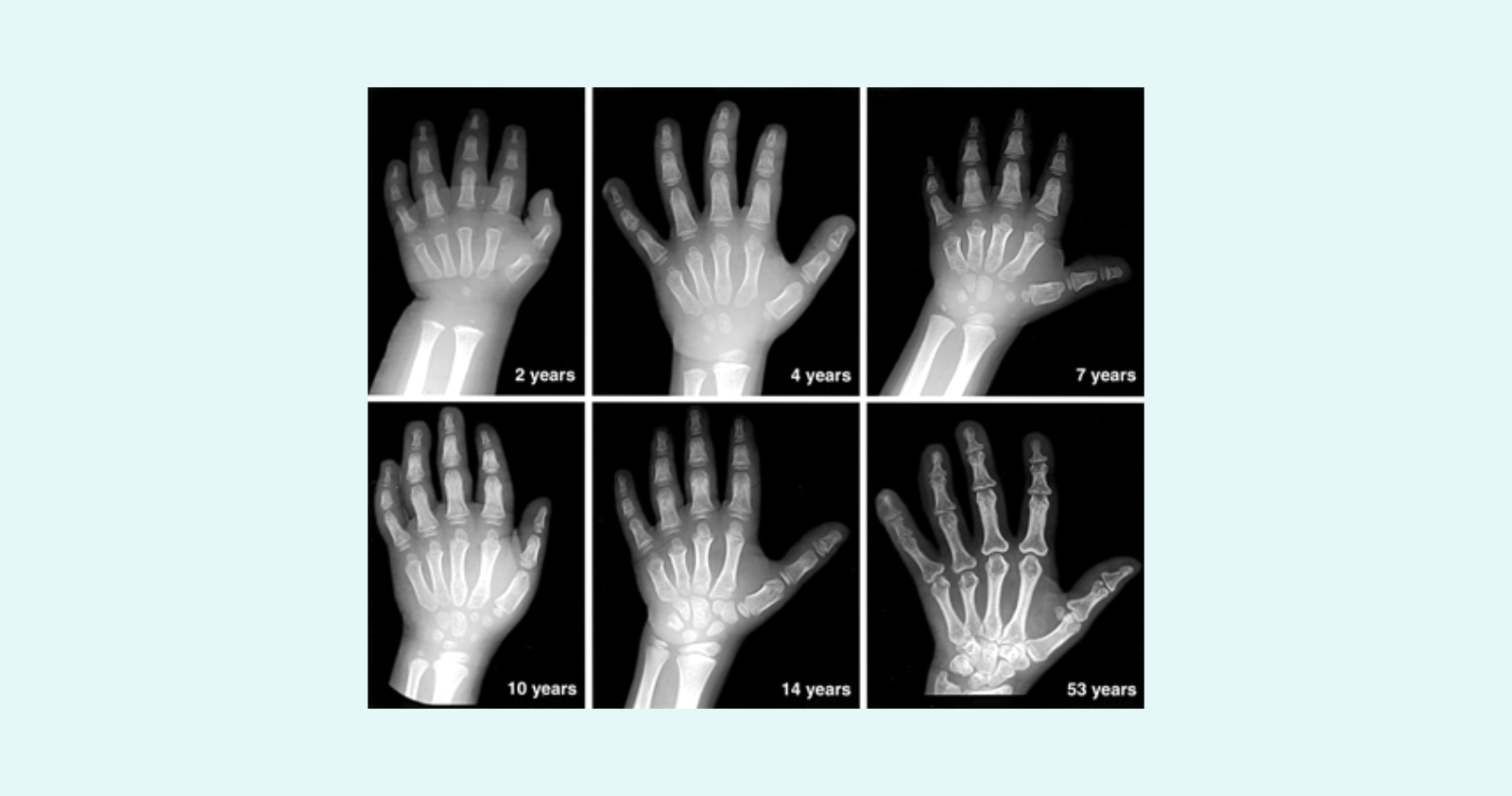 How does our hand develop? - Hanrahan Health - Therapy Services