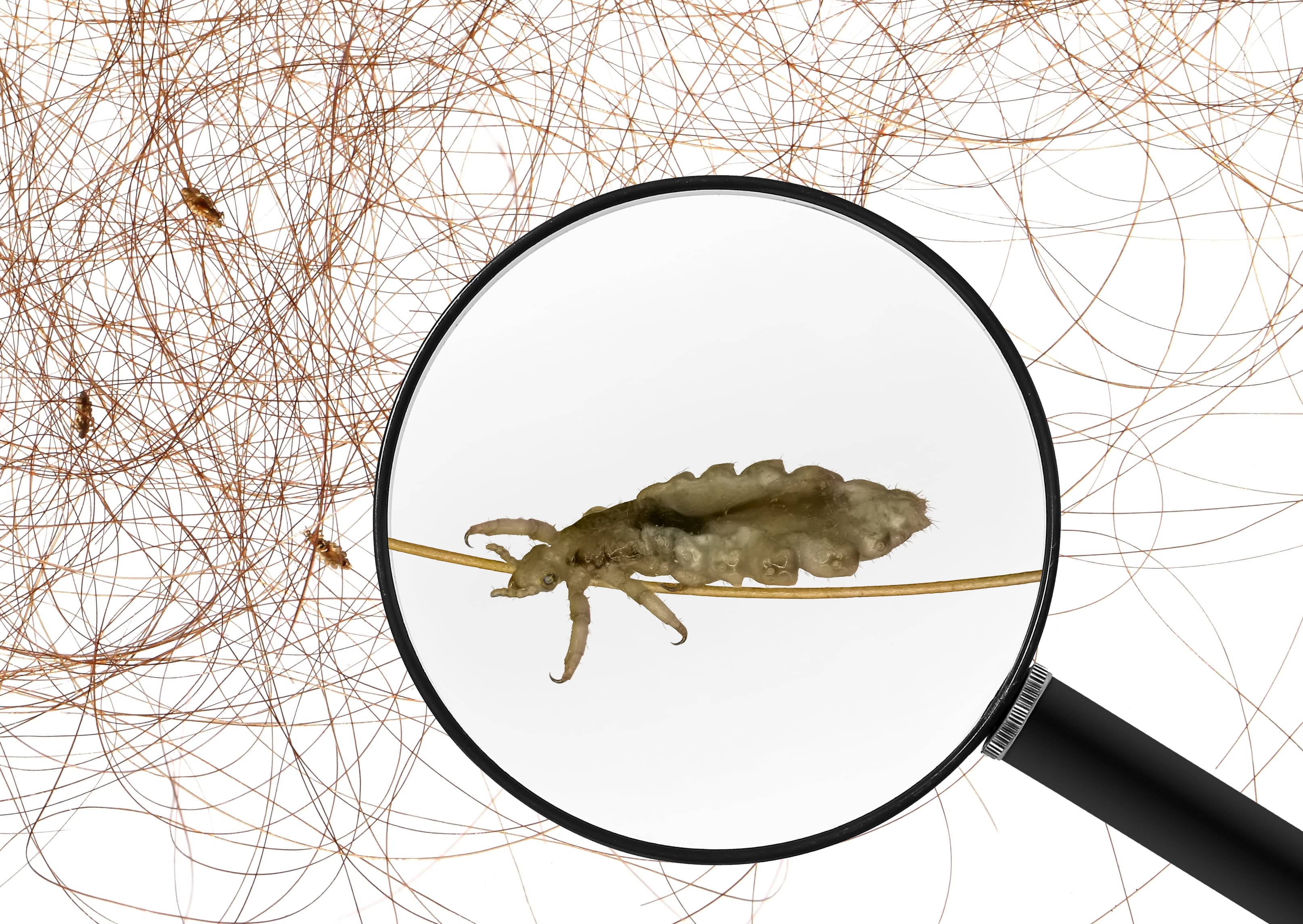 Lice Facts and Myths | LiceDoctors