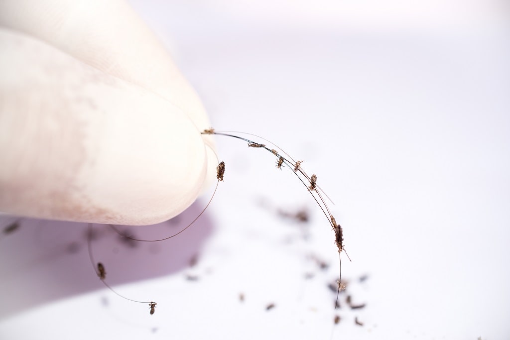 Frequently Asked Questions About Head Lice | LiceDoctors