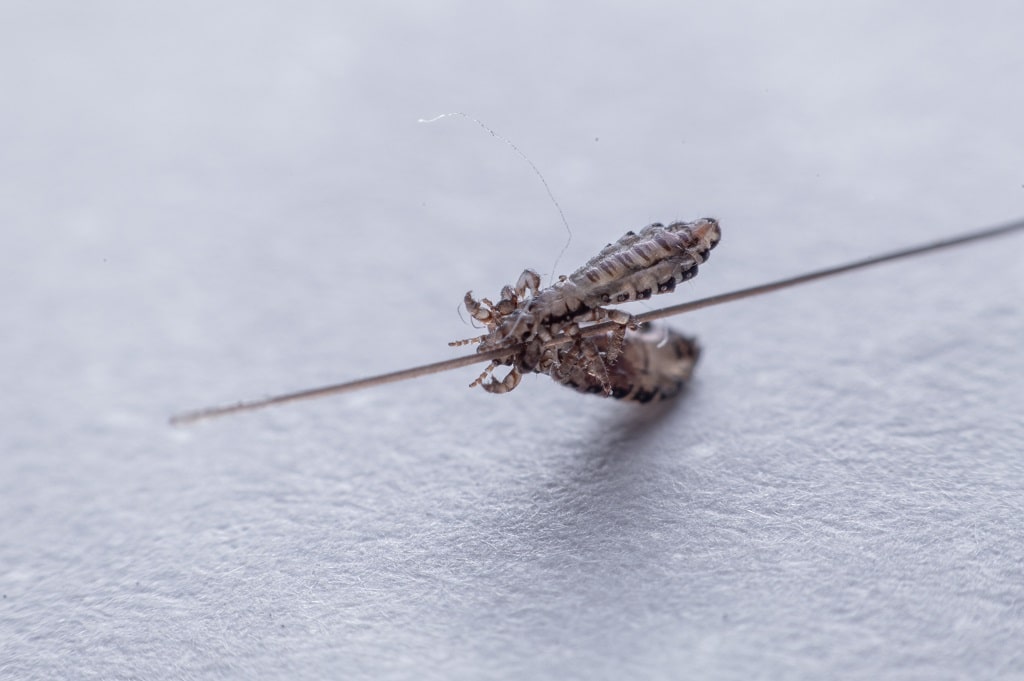 Frequently Asked Questions About Head Lice | LiceDoctors