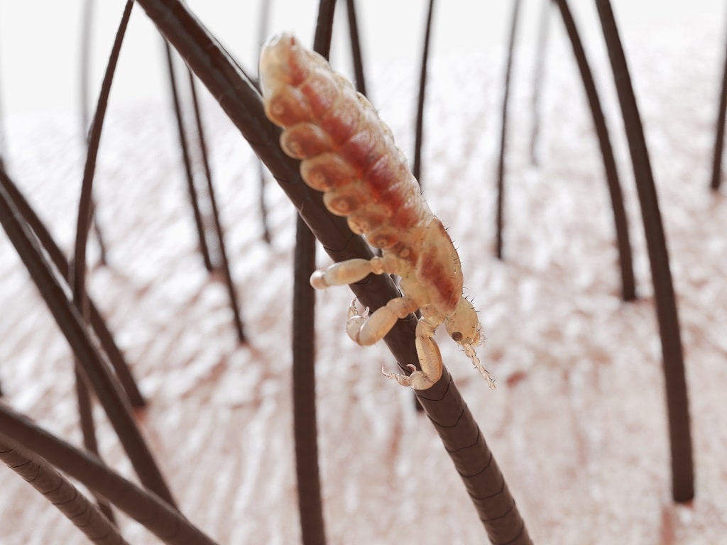 Top Myths and Facts About Head Lice | LiceDoctors