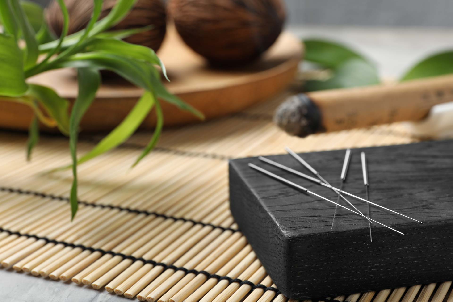 Points of Interest Acupuncture | Canton, MA