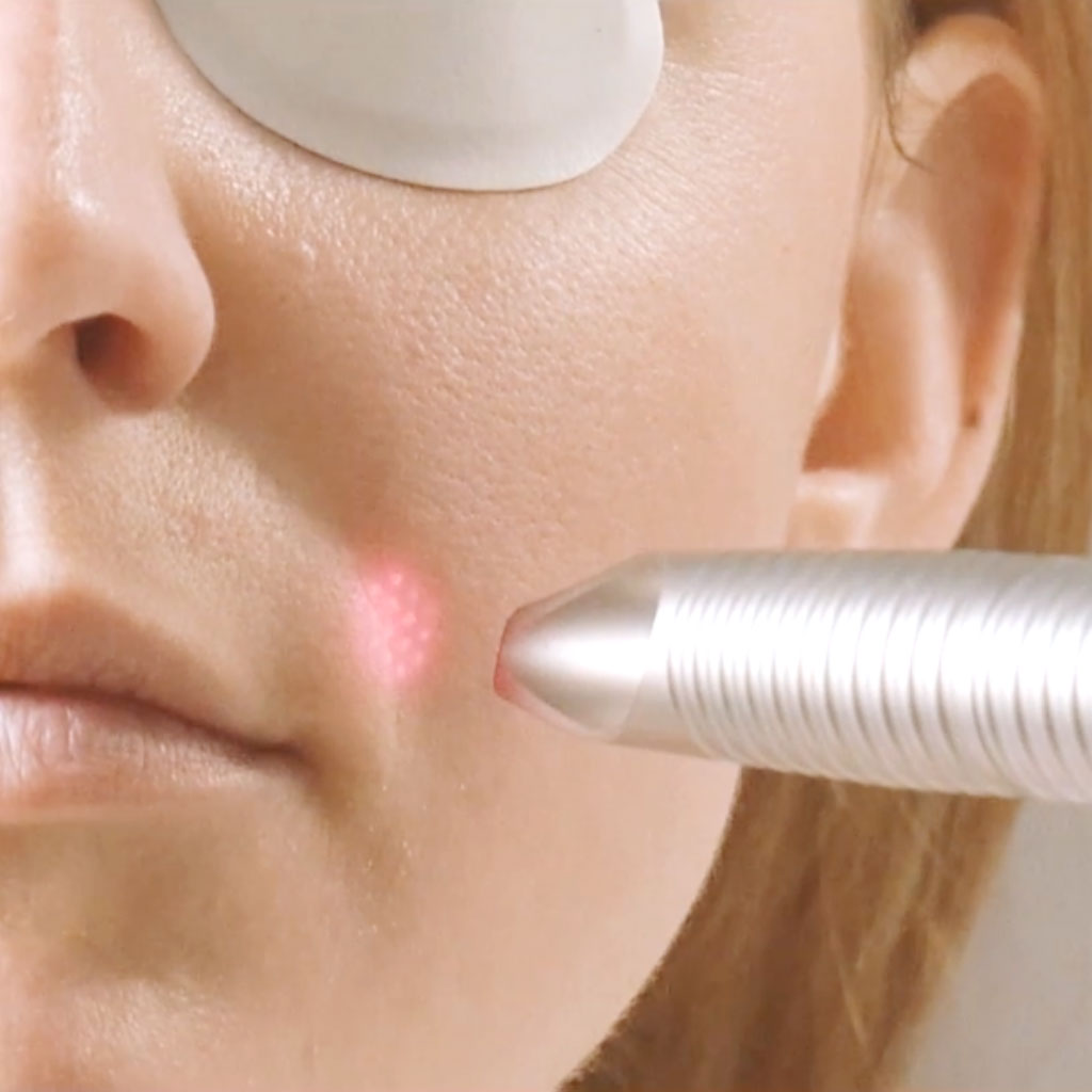 BB Health Clinic ⎮ BTL Emtone