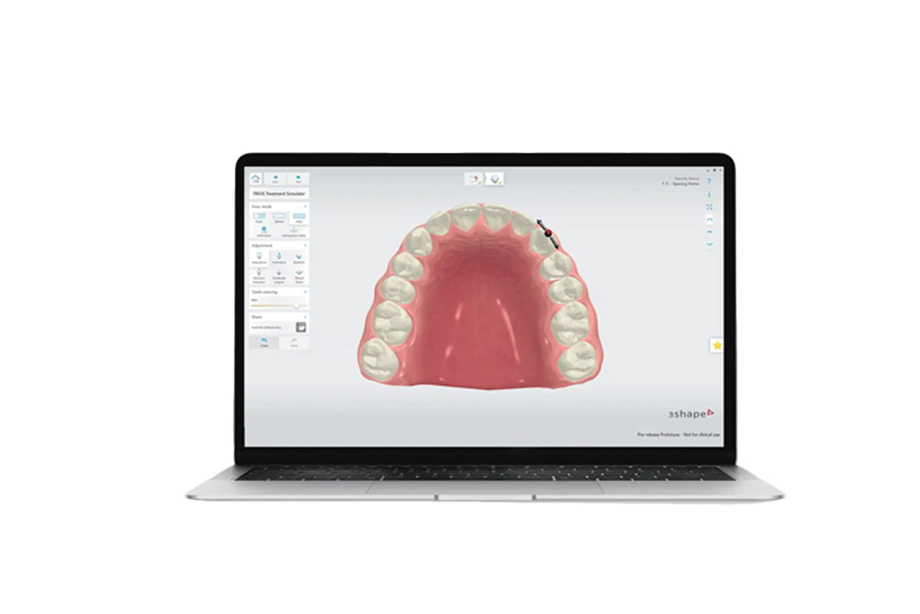 SCANNER INTRAORAL 3SHAPE TRIOS 3