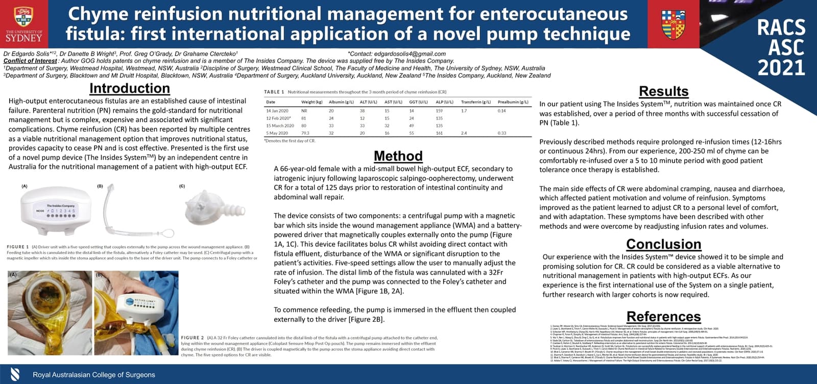 Chyme Reinfusion Nutritional Management for Enterocutaneous Fistula