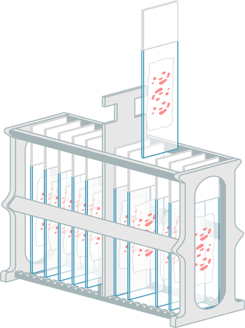 IHQ segunda etapa: recuperación de antígenos