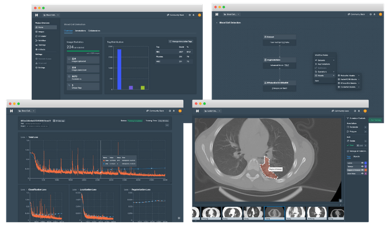 Datature - Smart City