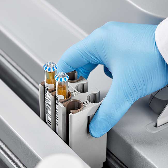 America ByDesign | Innovations | Atellica® CI 1900 Analyzer