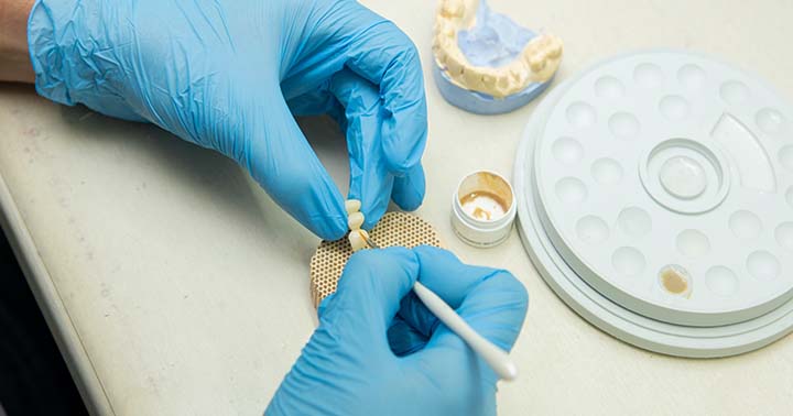 Leiðbeiningar eftir implantaaðgerð