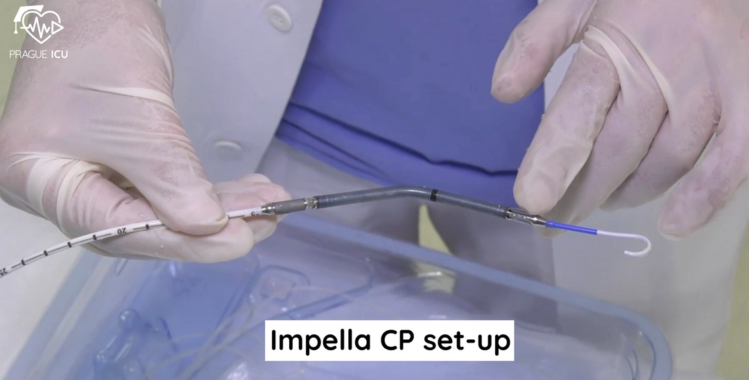 Workflow Blog: Impella CP set-up