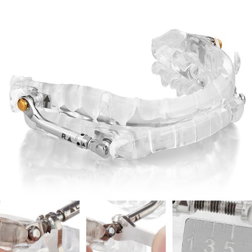 Titrate FDA-Approved Oral Appliance for Sleep Apnea | BlueSleep