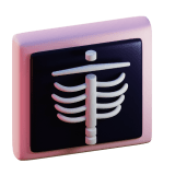 Rendgen dijagnostika - ono što treba da znate